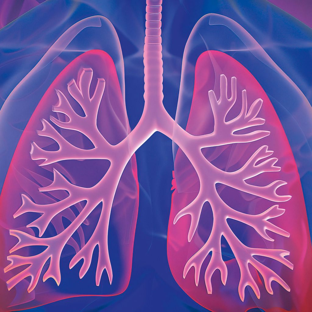 Statine bei idiopathischer Lungenfibrose - Pneumologie - Universimed - Knowledge that matters